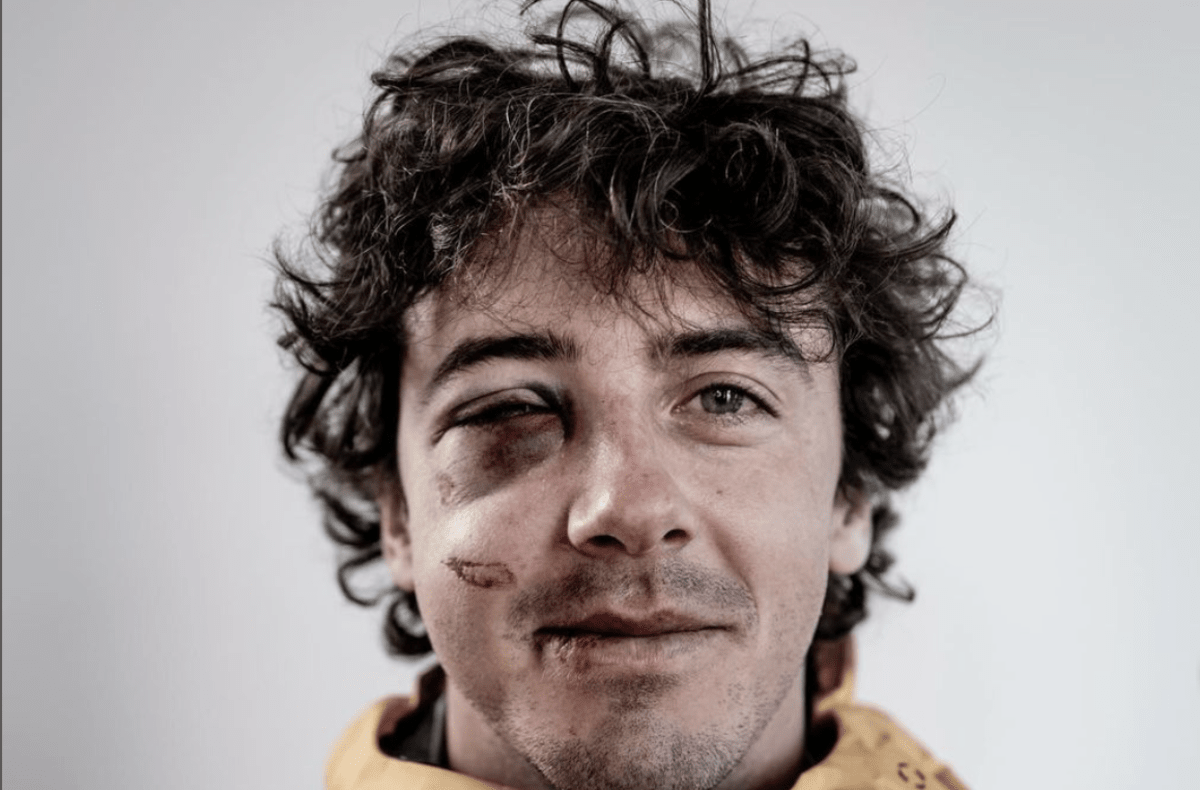 Mark McMorris Suffers From Severe Face Injury